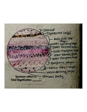 Case no 1 - Case #1 - Centro Escolar University College of Optometry ...