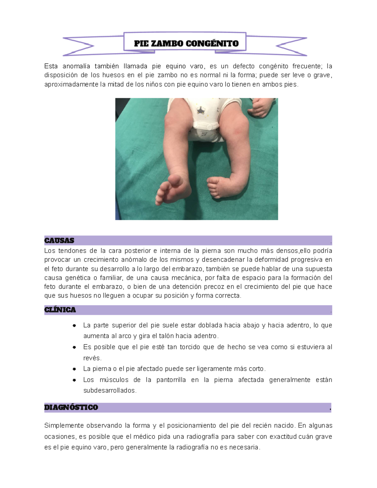 Pie zambo congenito - Esta anomalía también llamada pie equino varo, es ...