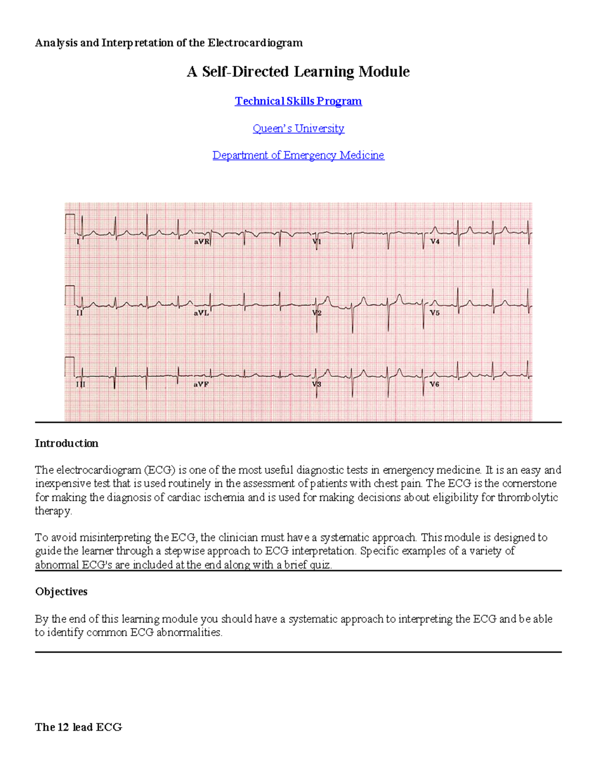 ECG module printable - ECG rhythm recognition - Analysis and ...