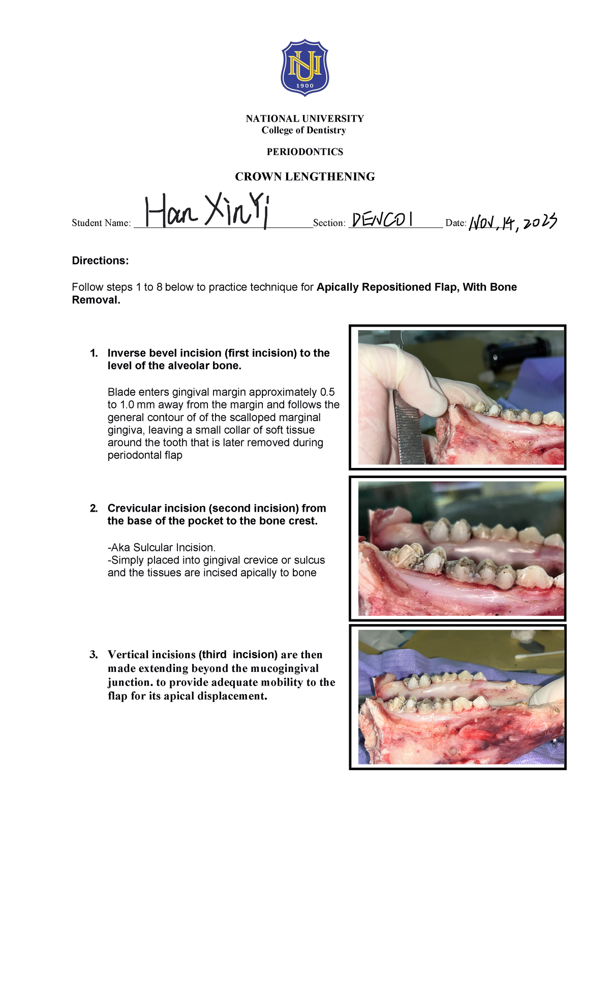 CL-Han Xin Yi - Wxwxwxw - NATIONAL UNIVERSITY College of Dentistry ...