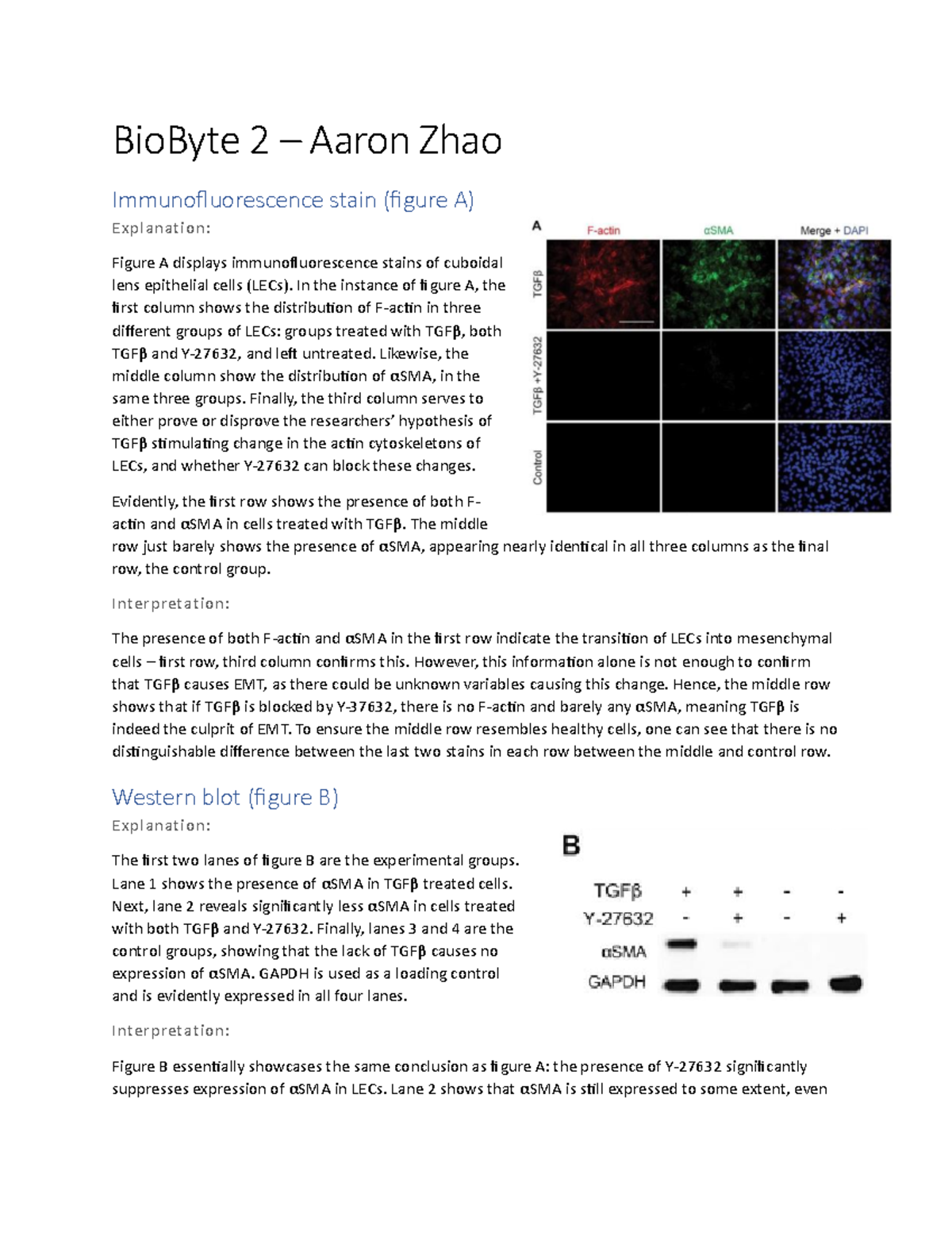 1EP6 BB2 Assignment - BioByte 2 – Aaron Zhao Immunofluorescence stain ...