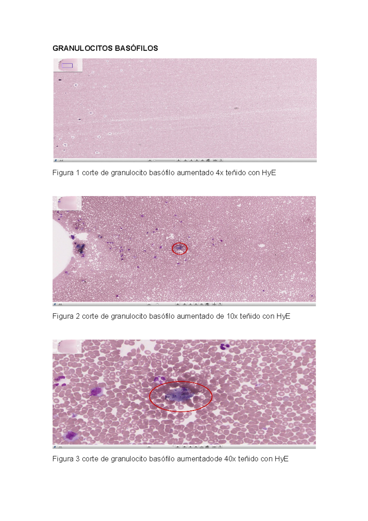 Granulocito Basofilo - laminas histologicas - GRANULOCITOS BASÓFILOS ...