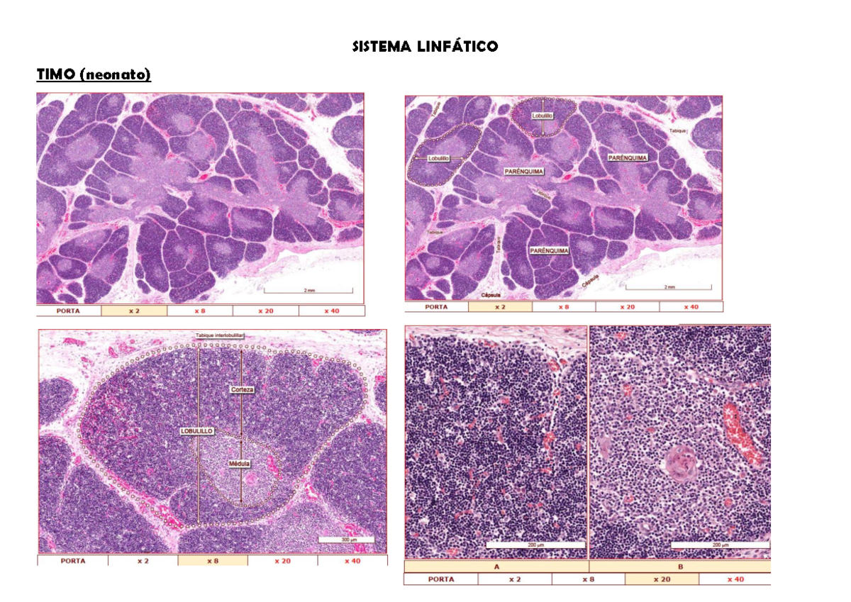 Sistema Linfático - Histología - SISTEMA LINFÁTICO TIMO (neonato) TIMO ...