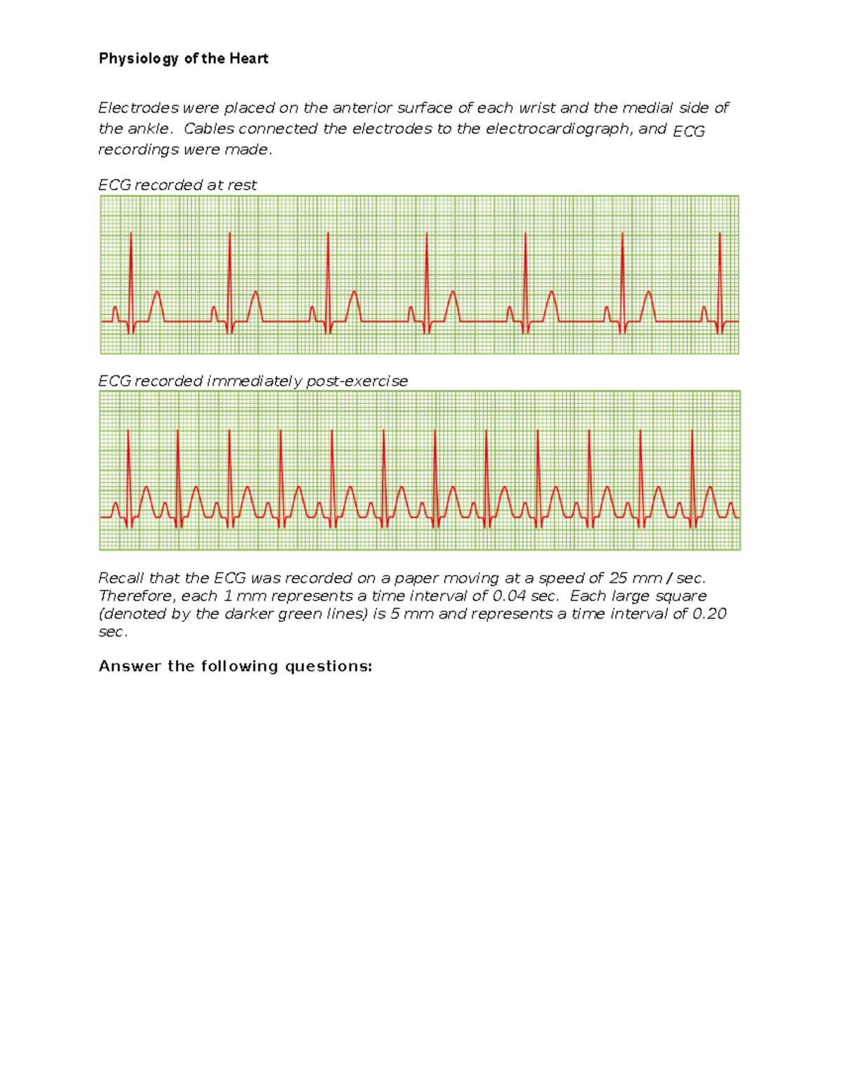 ECG worksheet - Physiology of the Heart Electrodes were placed on the ...