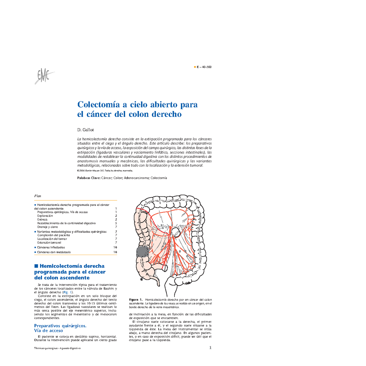 40-560 - ........... ............. - Colectomía a cielo abierto para el ...
