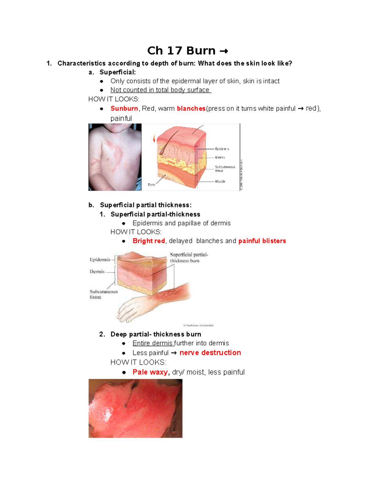 Study Guide EXAM 4 - Ch 17 Burn → 1. Characteristics according to depth ...