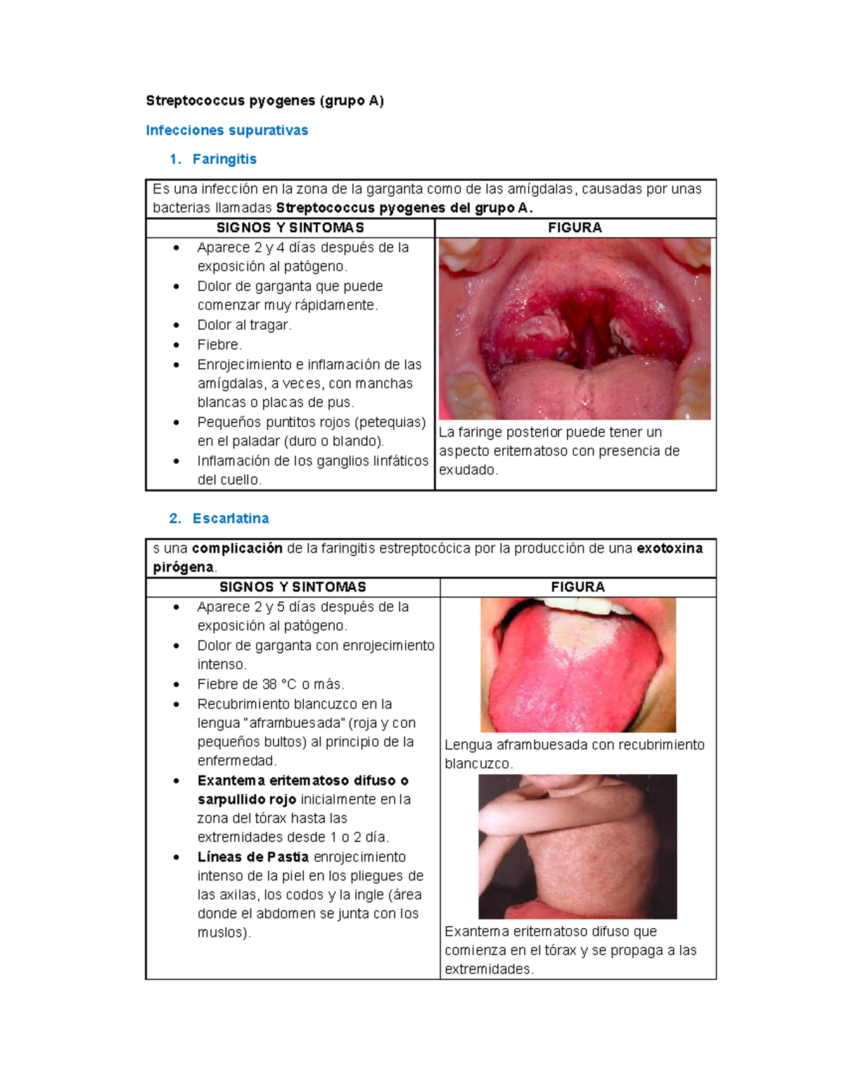 Streptococcus pyogenes - Faringitis Es una infecciÛn en la zona de la ...