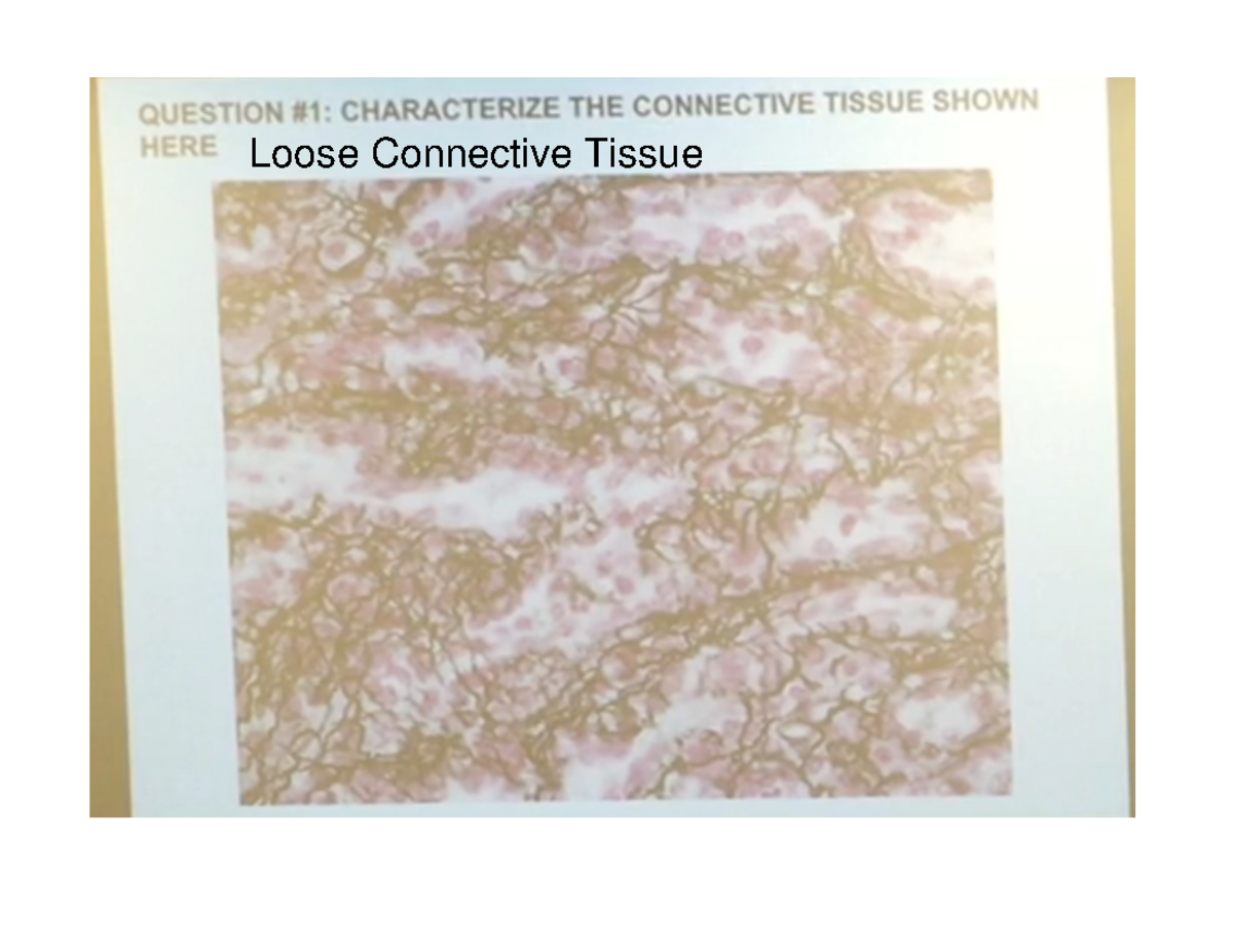 Midterm (Practice) - BIOL 302 - Loose Connective Tissue Desmosome ...