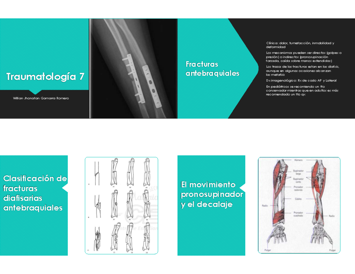 Traumatología 7 - MATERIAL ESTUDO - TraumatologÌa 7 Willian Jhonatan Gamarra Romero Fracturas ...