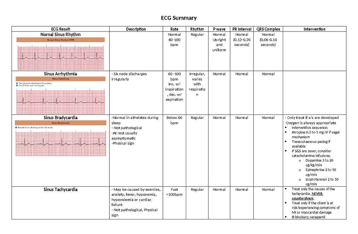 ECG- Summary - Made easy - ECG Summary ECG Result Description Rate ...