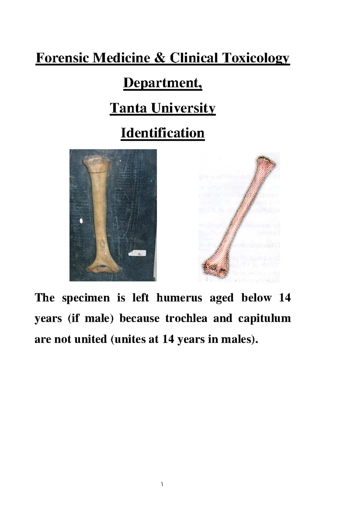 Identification - ١ Forensic Medicine & Clinical Toxicology Department ...