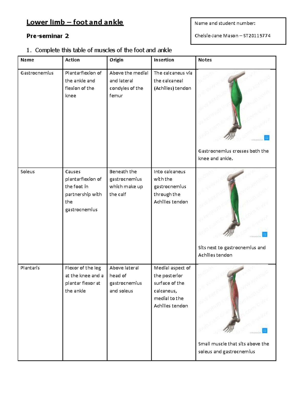 Foot and ankle 2 - Anatomy of the foot - Warning: TT: undefined function: 32 Warning: TT ...