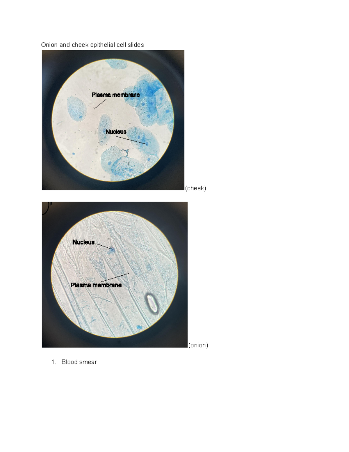 BIO 212 - Lab 9 - Google Docs - Onion and cheek epithelial cell slides ...