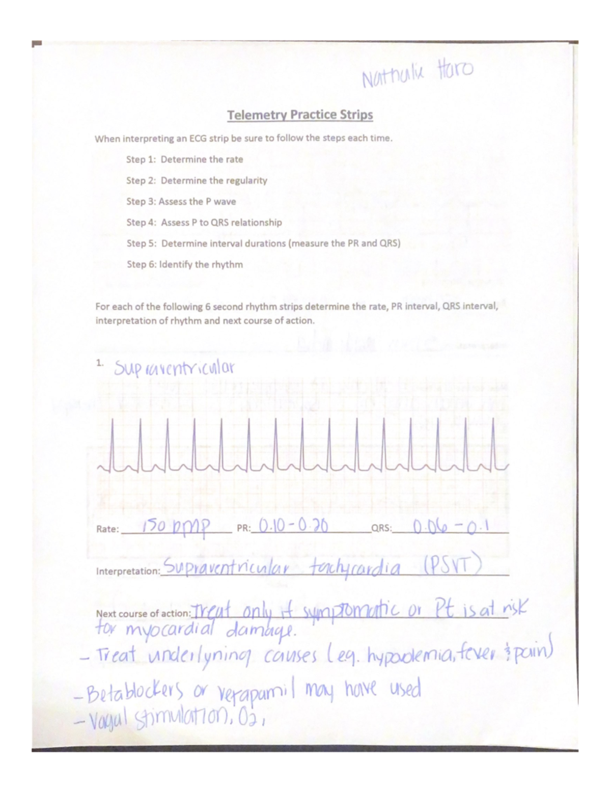 Telemetry Practice Strips hw completed - ADN 180 - Studocu