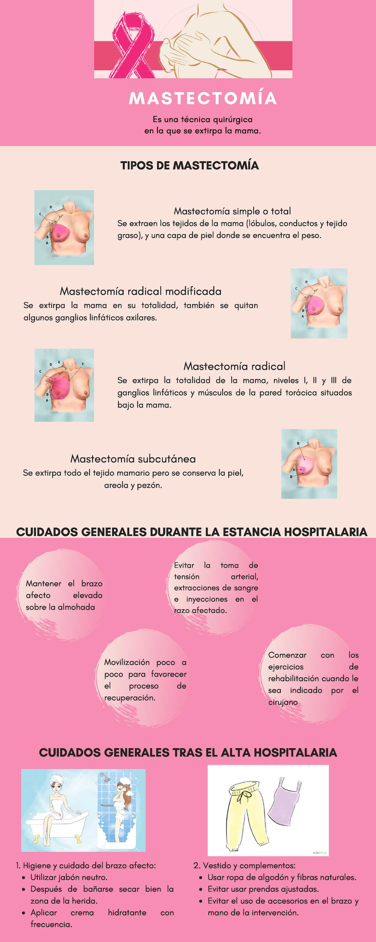 Mastectomía - enfermeria - UVM - Studocu