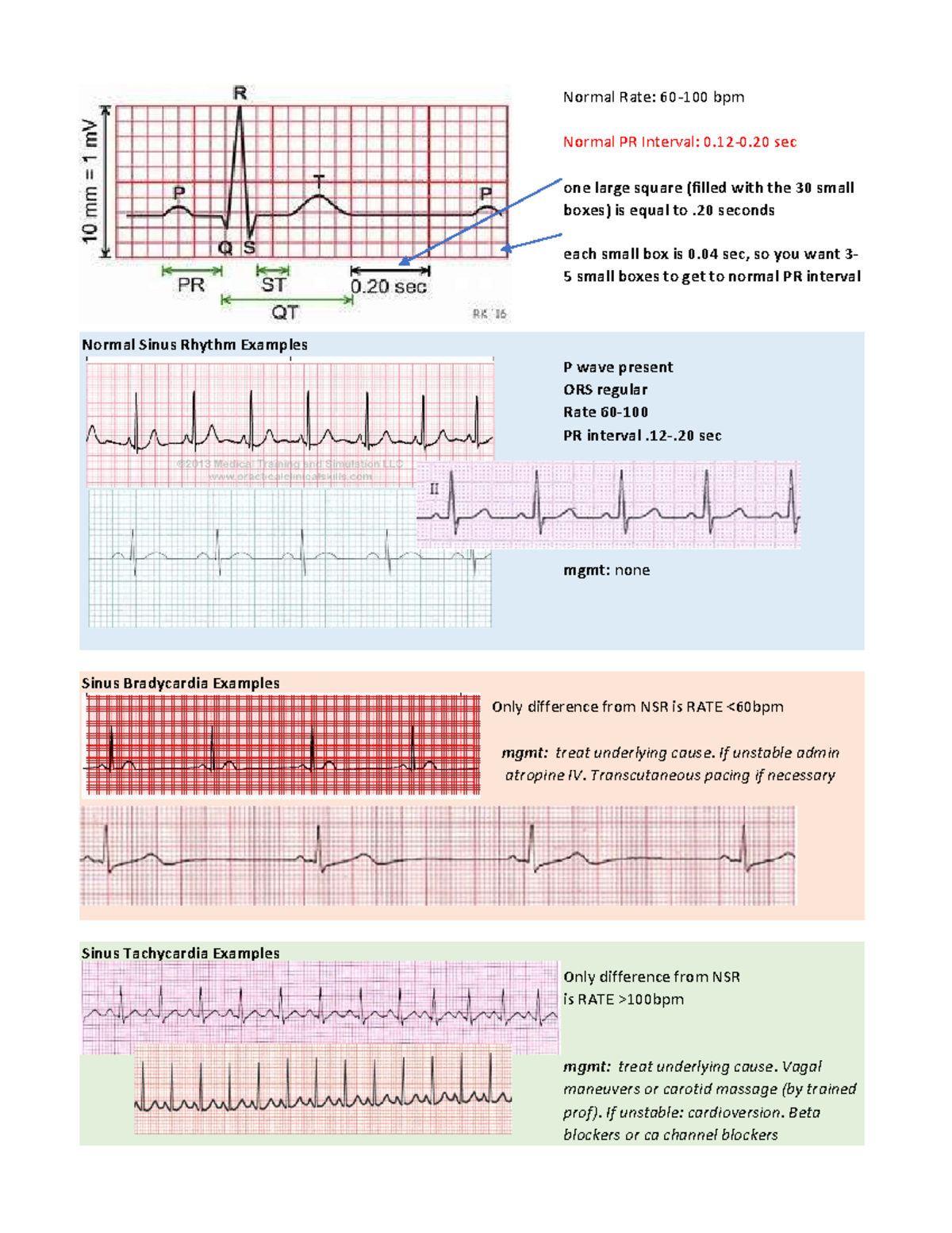 EKG guide pdf - n/a - Normal Rate: 60-100 bpm Normal PR Interval: 0.12 ...