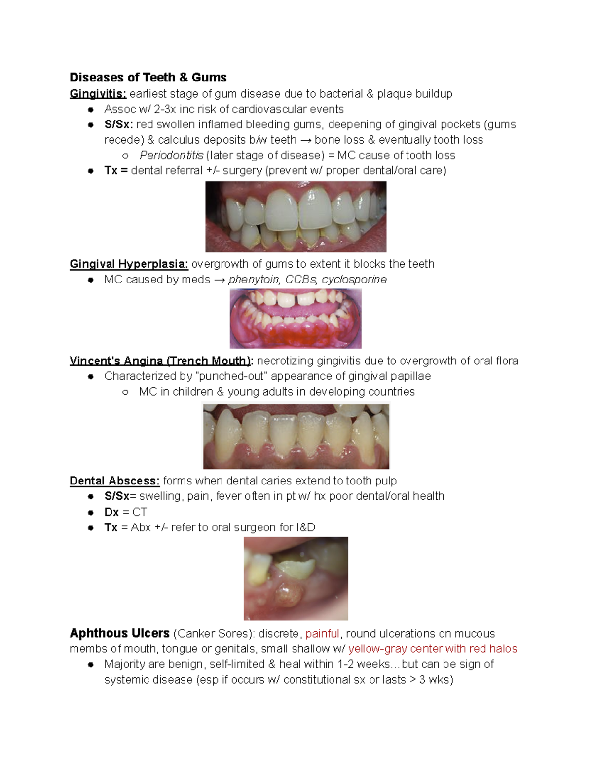 Oropharyngeal Teeth Gums - Diseases of Teeth & Gums Gingivitis ...