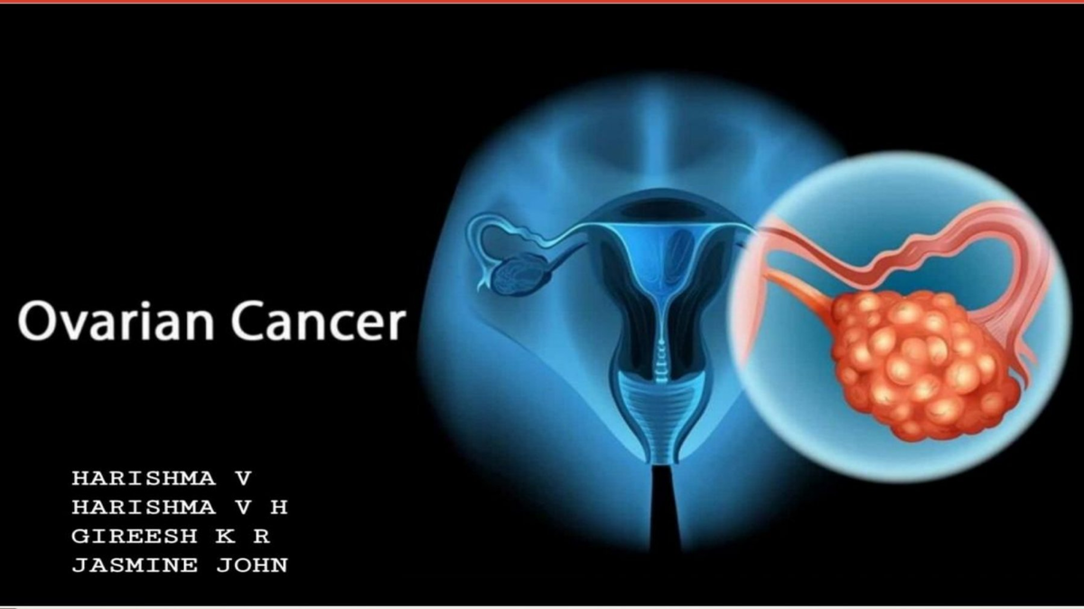 Ovarian Cancer Presentation - Bsc nursing - Studocu