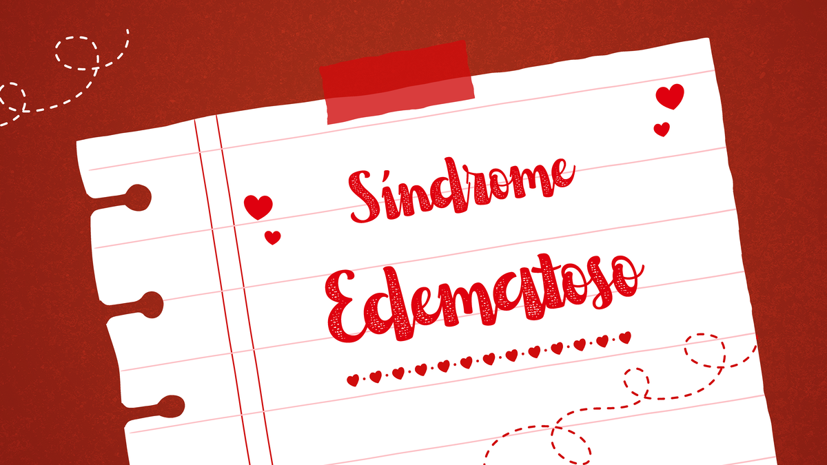 Síndrome edematoso - Síndrome Edematoso Es la acumulación de líquido ...