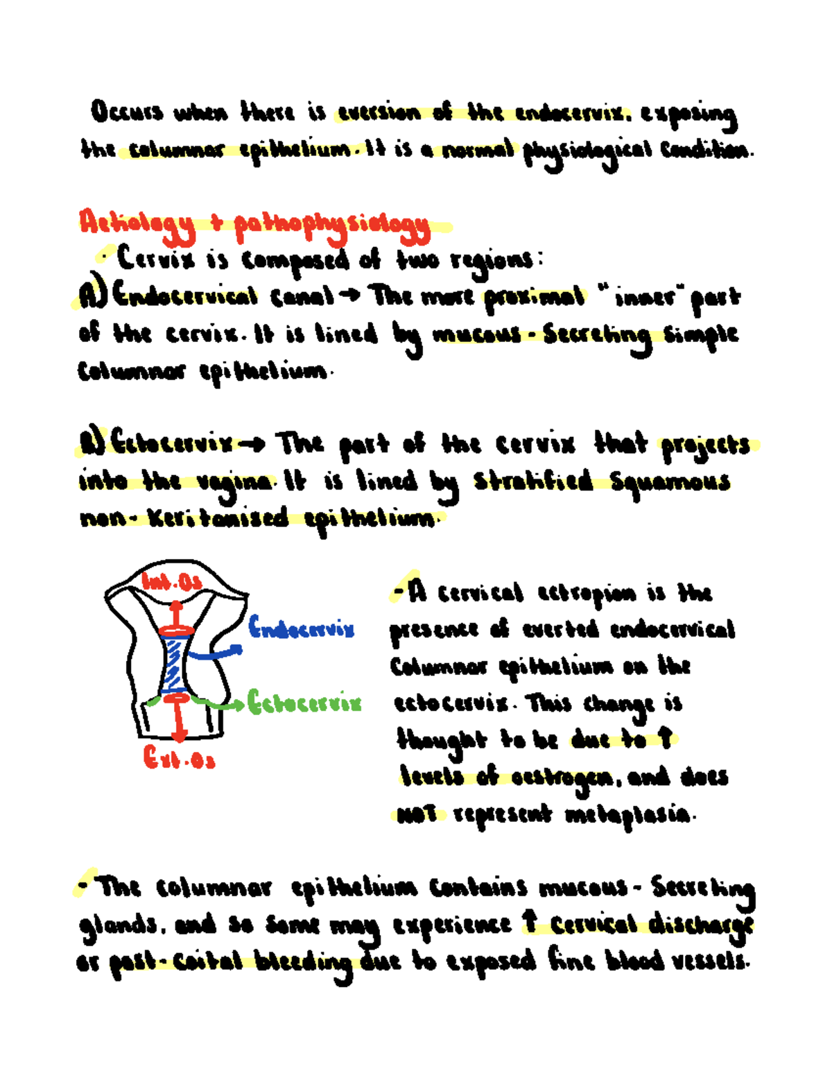 Cervical ectropion - Occurs when there is eversion of the endocervix ...
