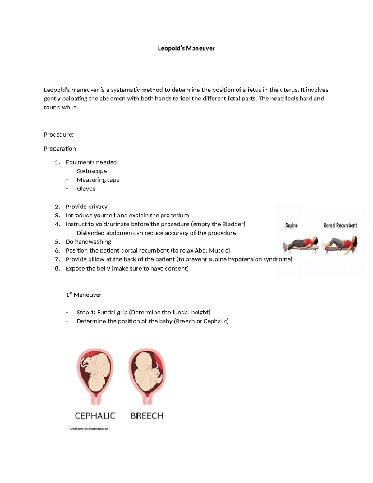Leopold - Leopold’s Maneuver Leopold's maneuver is a systematic method ...