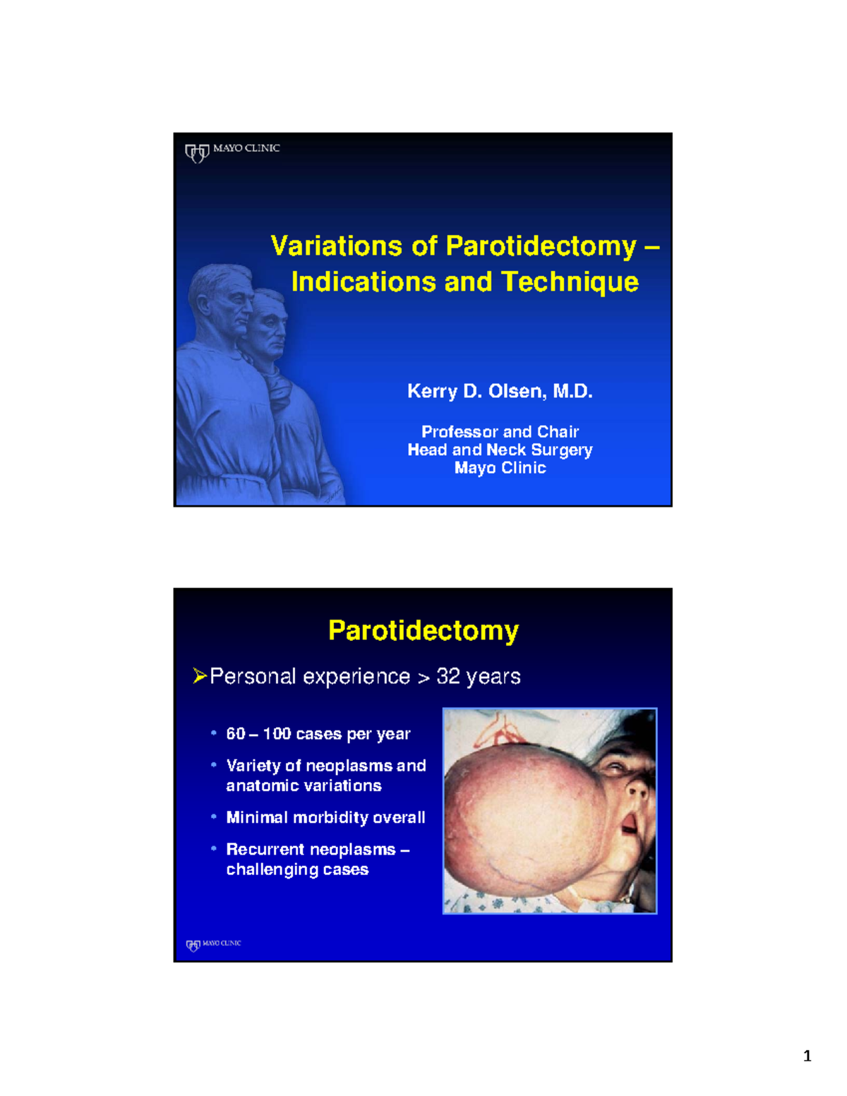 24 Olsen Variations Parotidectomy - Variations of Parotidectomy ...
