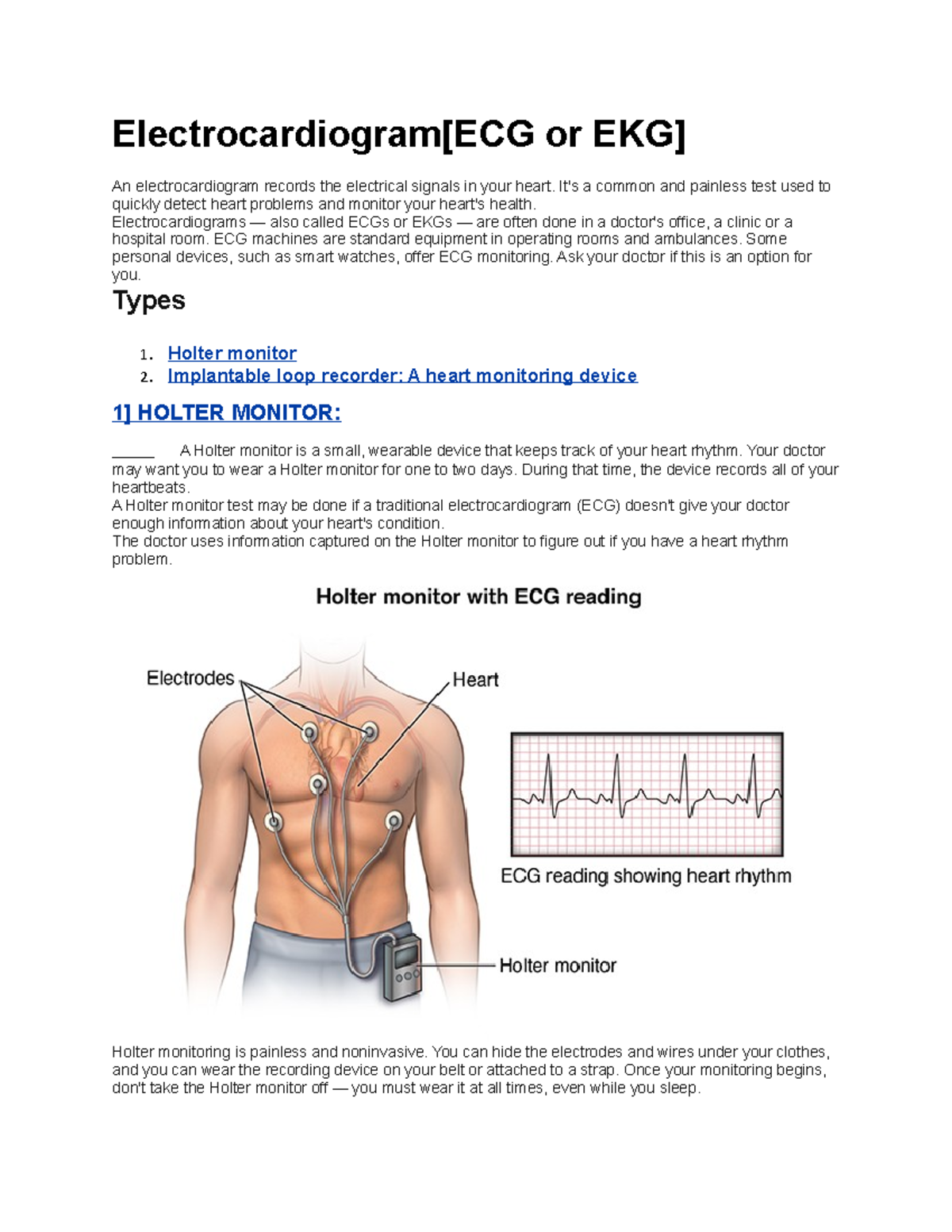 Electrocardiogram parts and uses - Electrocardiogram[ECG or EKG] An ...