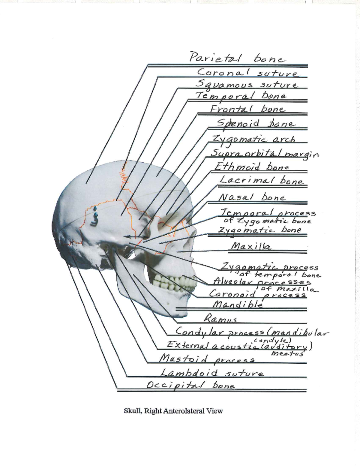 Photo Labeling Handout Skull w Answers - Parietal bone Coronal suture ...