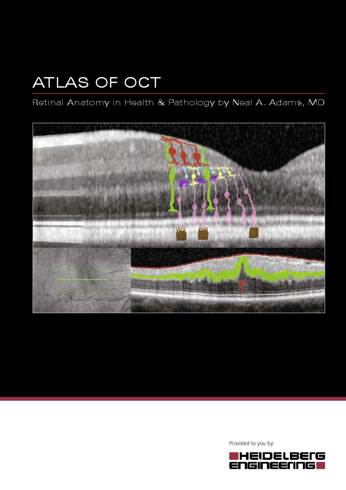 Atlas of OCT 2 - Summary Optometry - ATLAS OF OCT Retinal Anatomy in ...