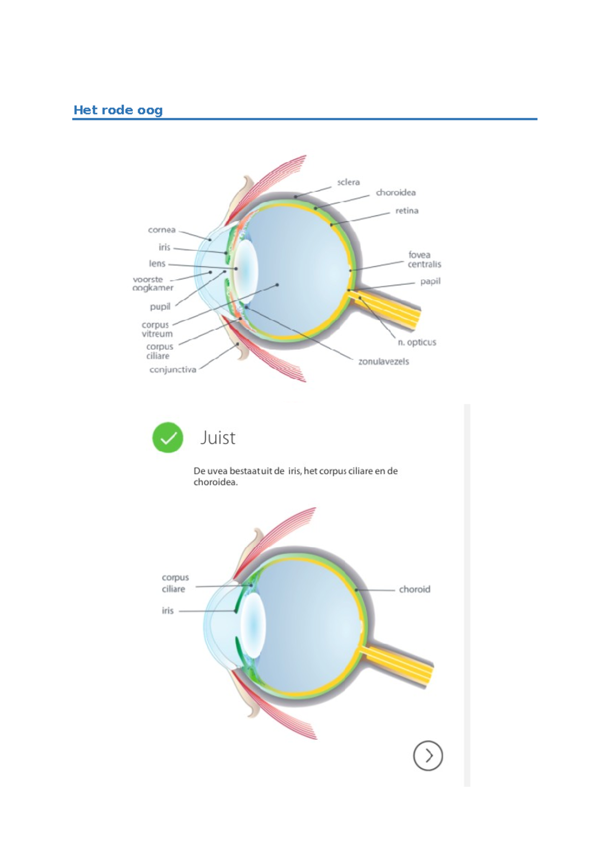 Het rode oog e learning - Coschap Oogheelkunde - Het rode oog - Studeersnel