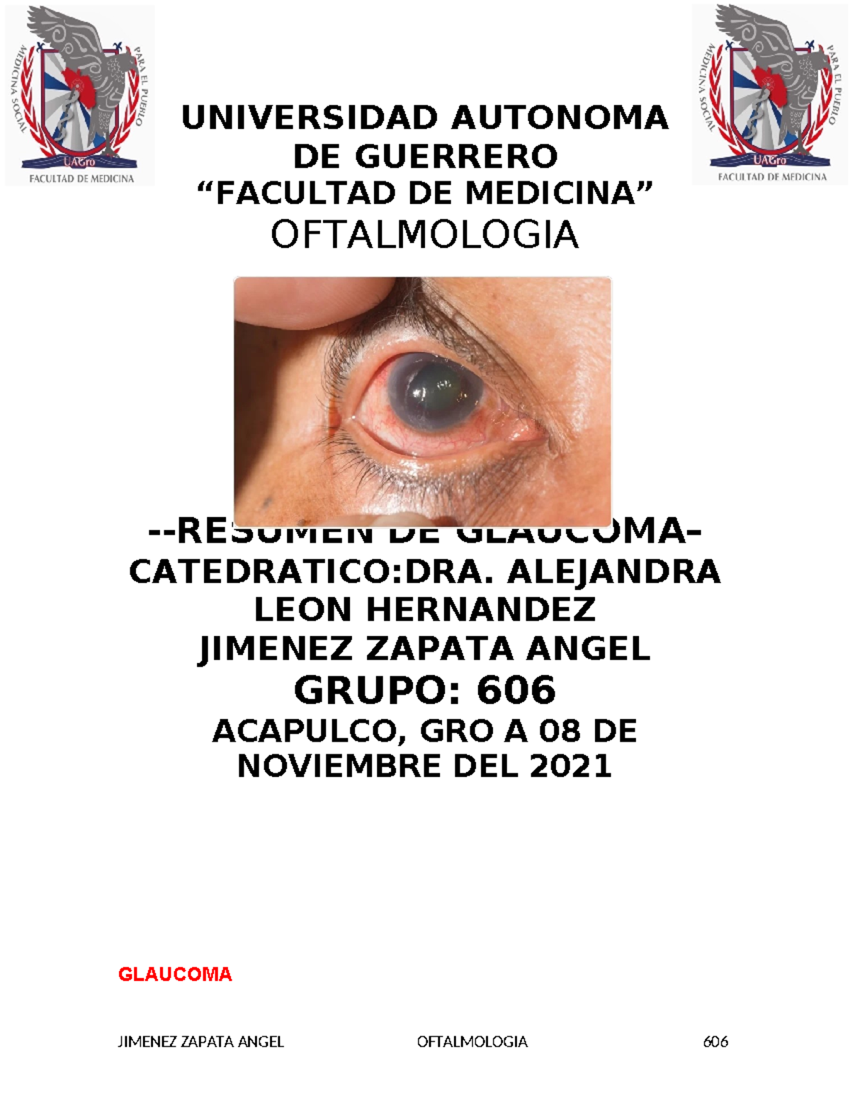Glaucoma OFTALMOLOGIA - UNIVERSIDAD AUTONOMA DE GUERRERO “FACULTAD DE MEDICINA” OFTALMOLOGIA ...