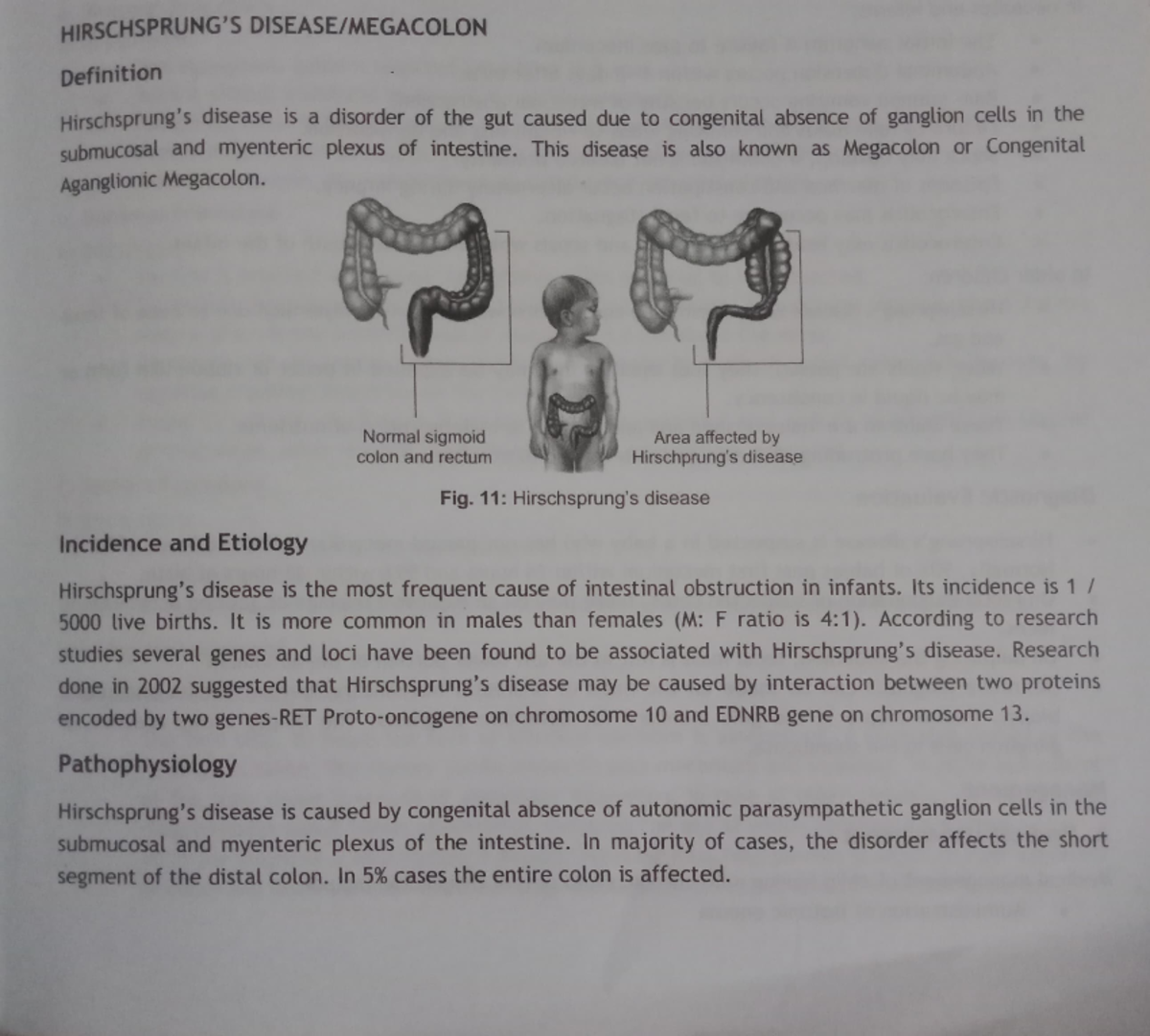Pediatrics (hirschsprungs disease) - HIRSCHSPRUNG'SDISEASE/MEGACOLON ...