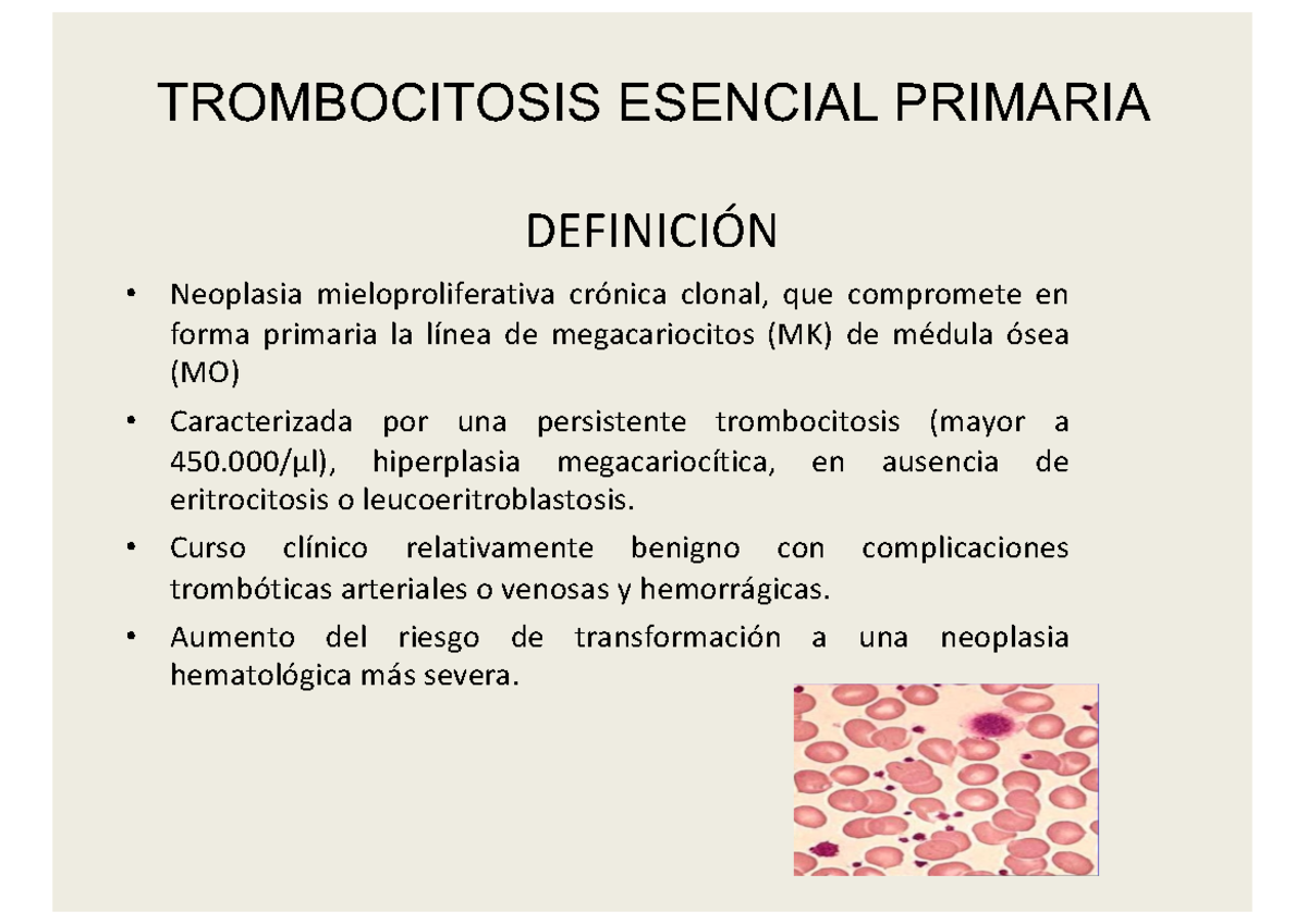 Trombocitosis Esencial - TROMBOCITOSIS ESENCIAL PRIMARIA DEFINICIÓN ...
