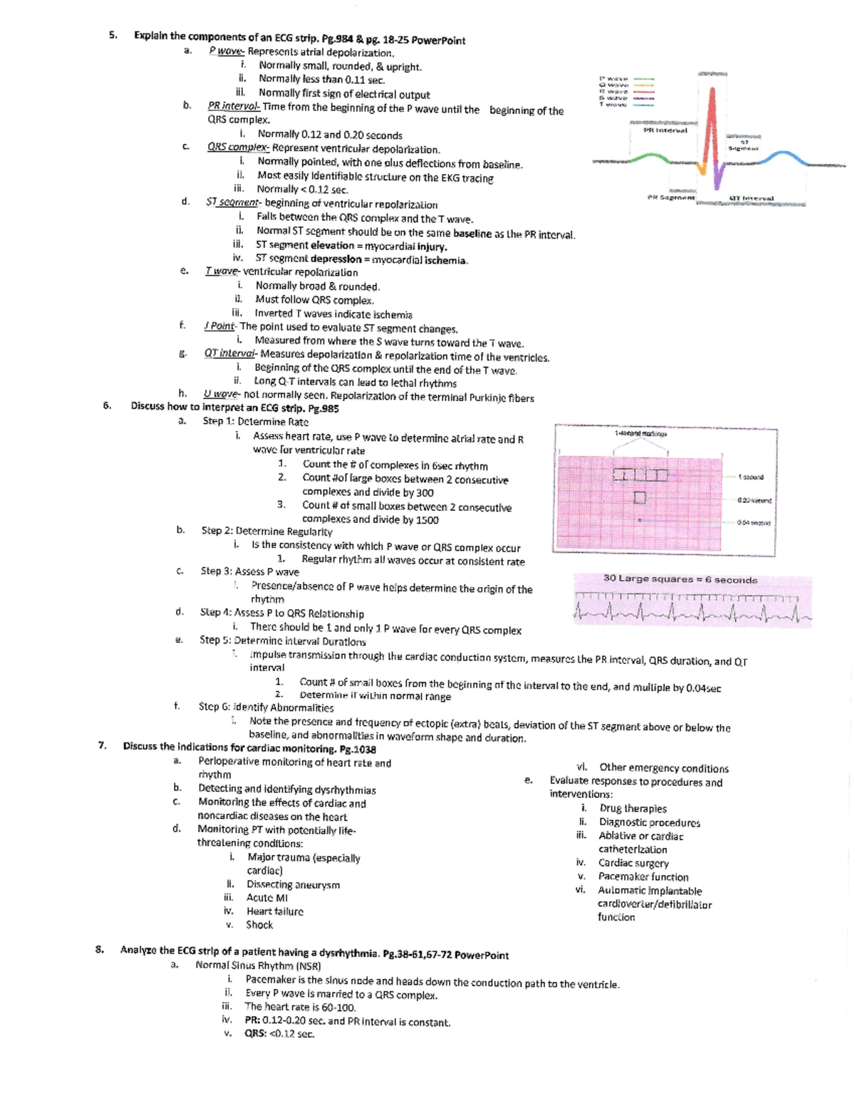 EKG breakdown - ekg - 5. Explain the components of an ECG strip. Pg pg ...