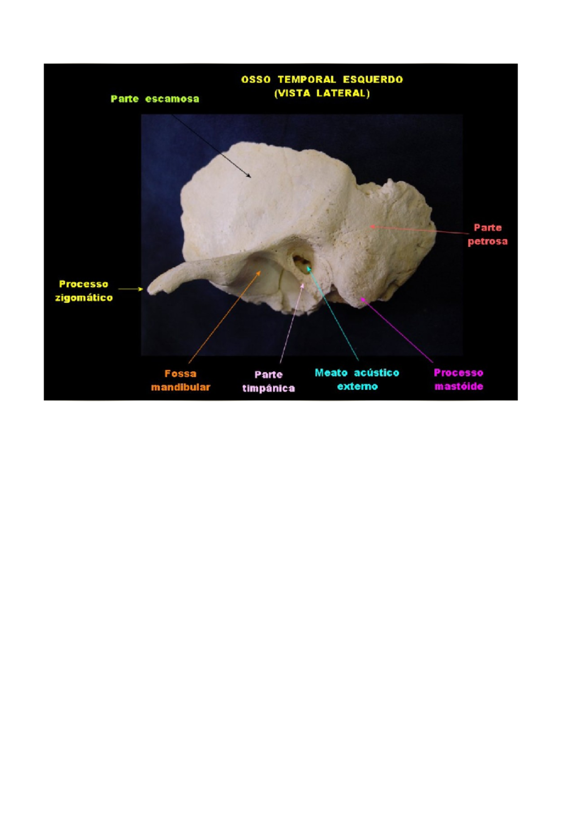 AULA Patologias OSSO Temporal - Medicina - Studocu