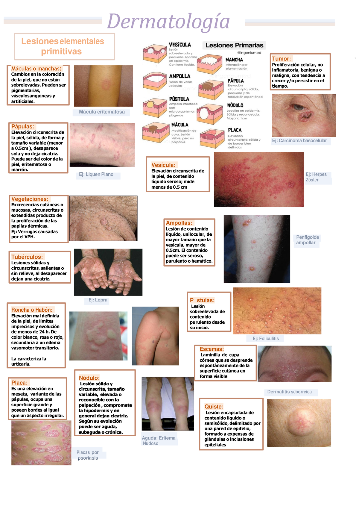 Dermatologia-lesiones-elementales removed - Mácula eritematosa Ej ...