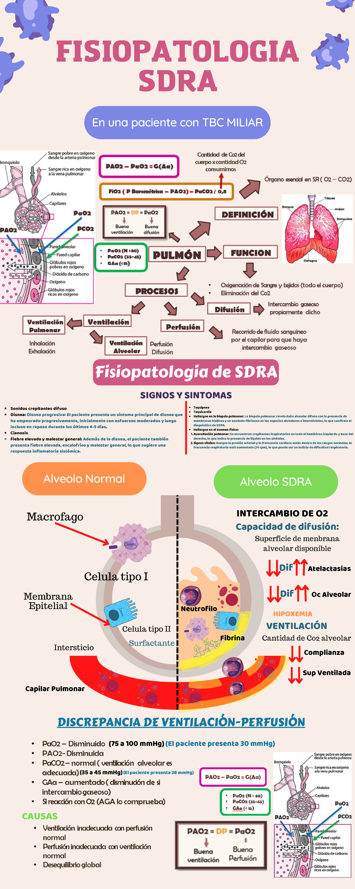 SDRA - SDRA - En una paciente con TBC MILIAR Alveolo Normal Alveolo ...