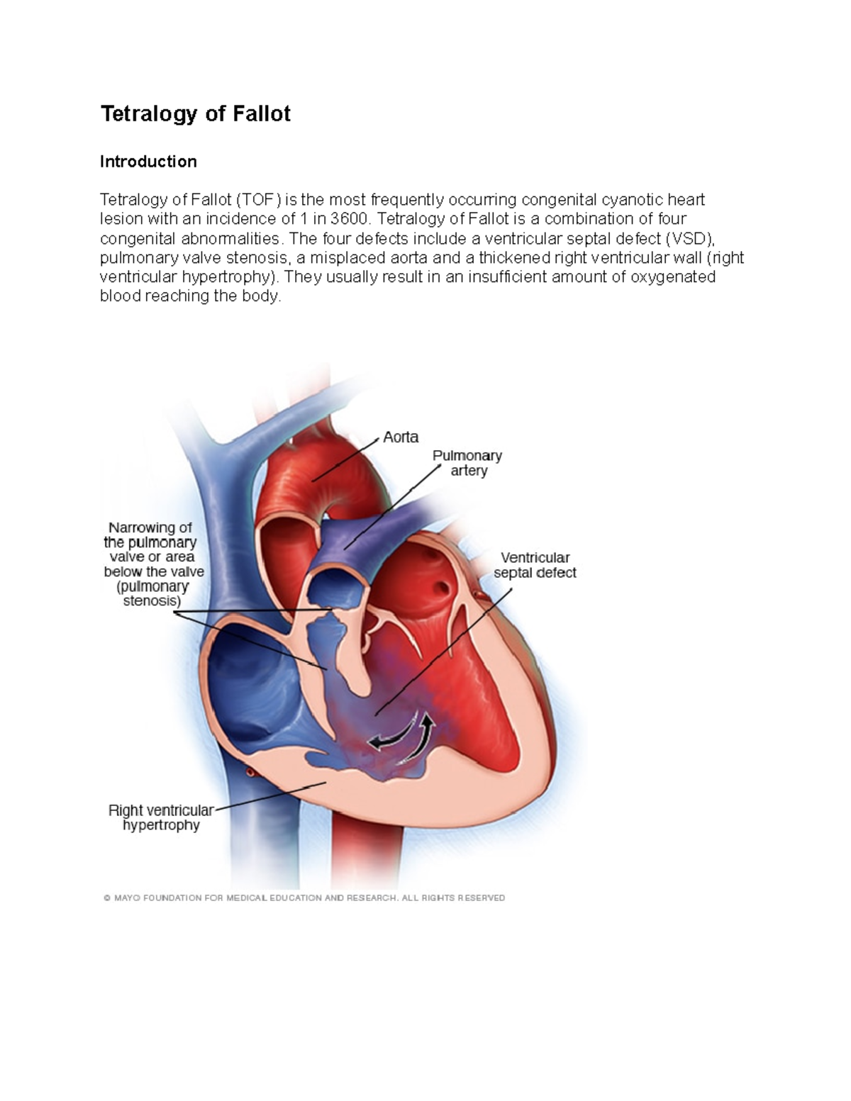 TOF-a50aa252-71ed-4d1e-82c4-d2cc48b7027a - Tetralogy of Fallot Introduction Tetralogy of Fallot ...