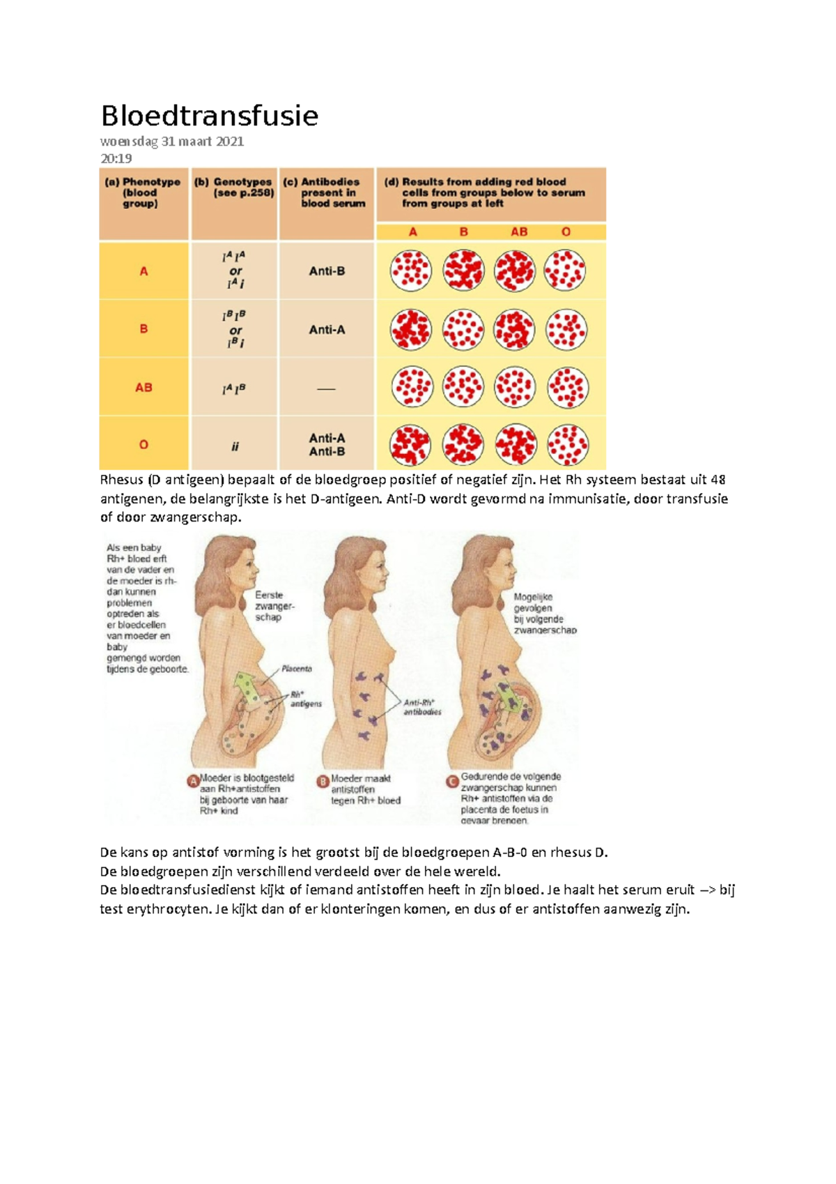 Bloedtransfusie - Bloedtransfusie woensdag 31 maart 2021 20: Rhesus (D antigeen) bepaalt of de ...