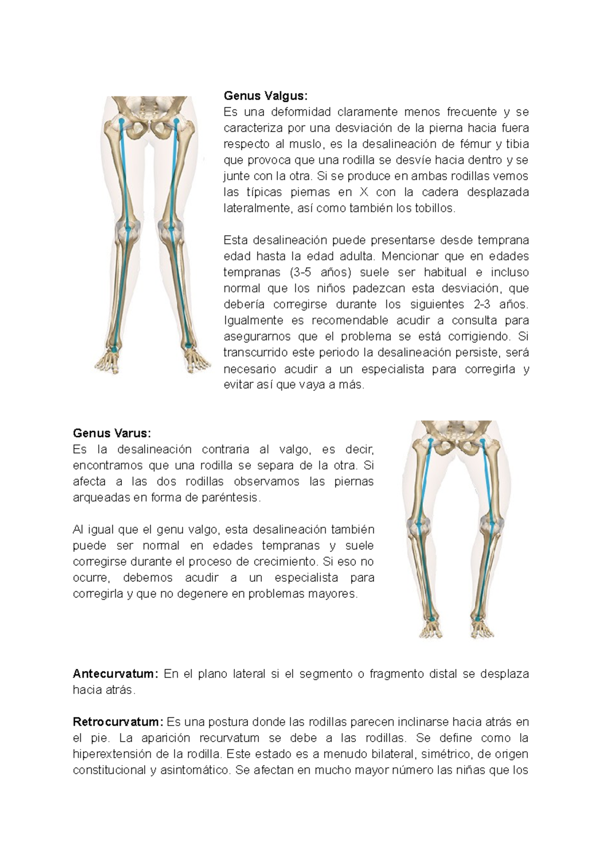 Genus valgus, Genus varus, Antecurvatum, Retrocurvatum y Escoliosis ...