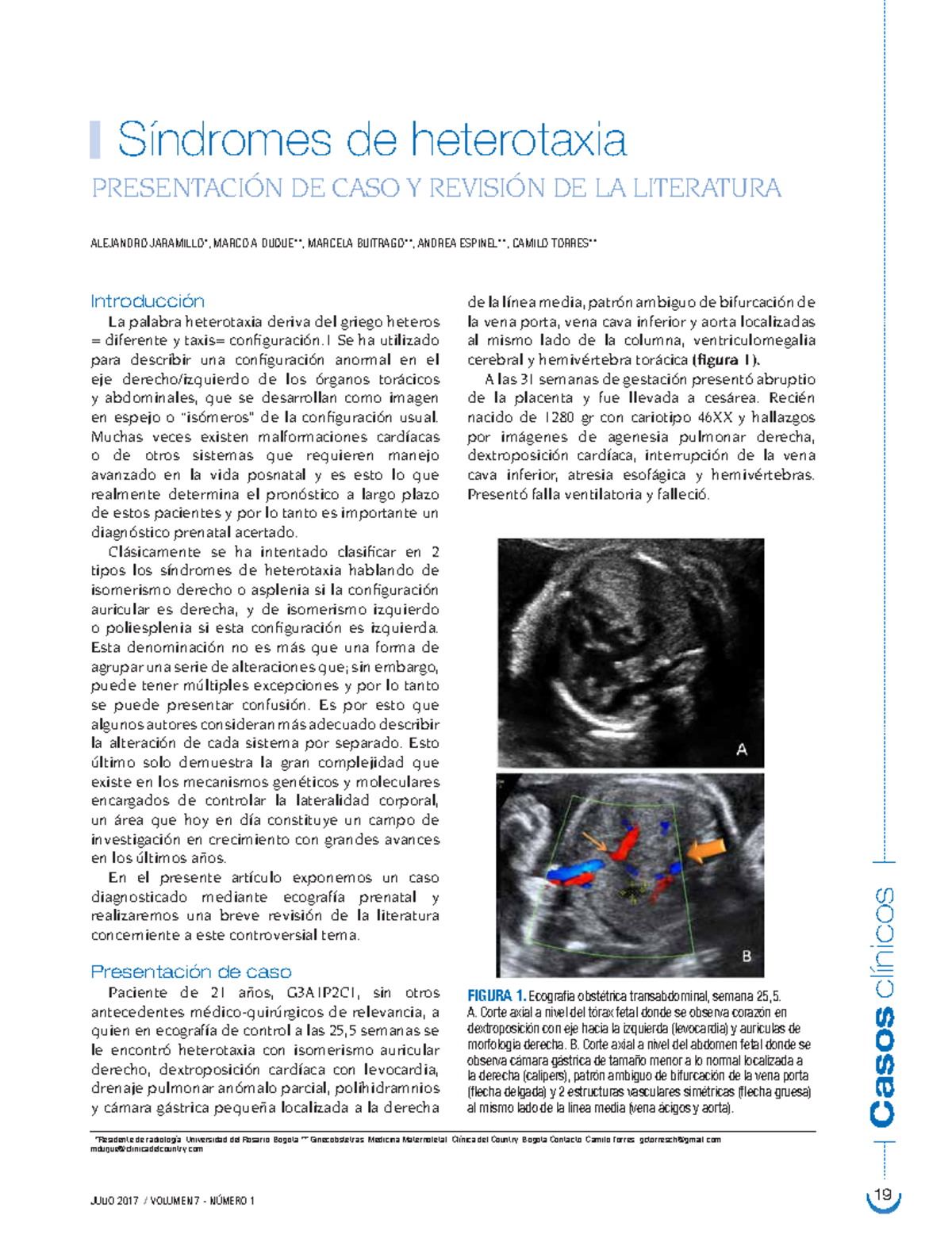 Sindromes-de-heterotaxia - 19 Casos clínicos JULIO 2017 / VOLUMEN 7 ...