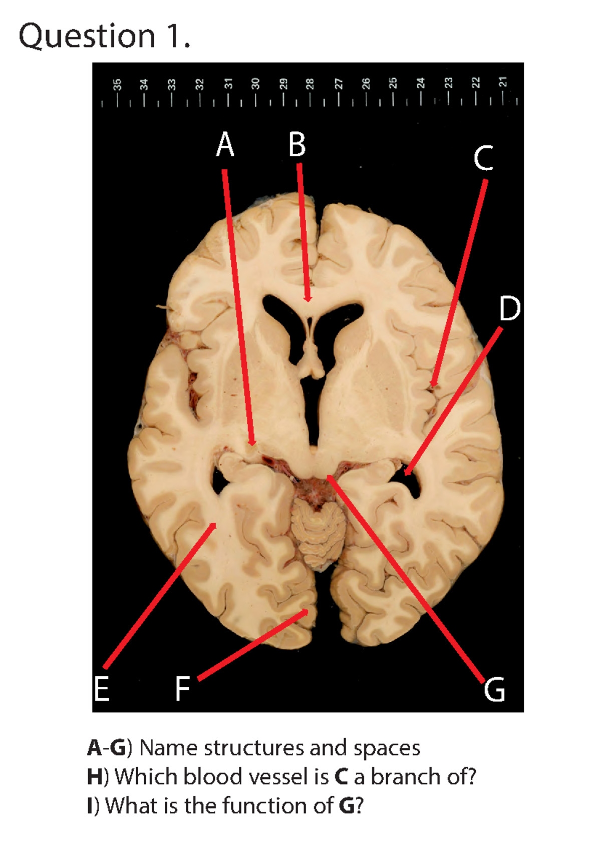 NEUR3005 Week 3 – Questions+Answers-2021 - A B C D E F G Question 1. A-G) Name structures and ...