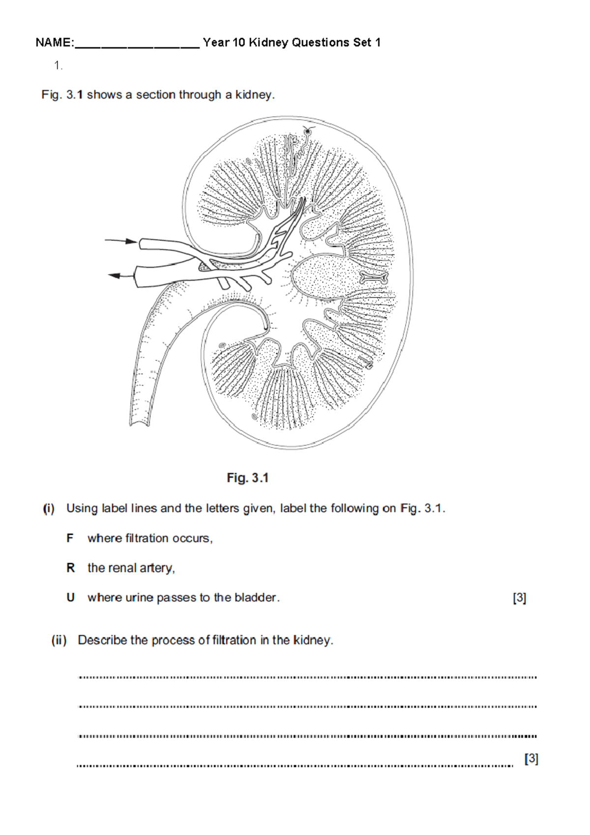 Kidney questions set 1 2018 - NAME:___________________ Year 10 Kidney ...