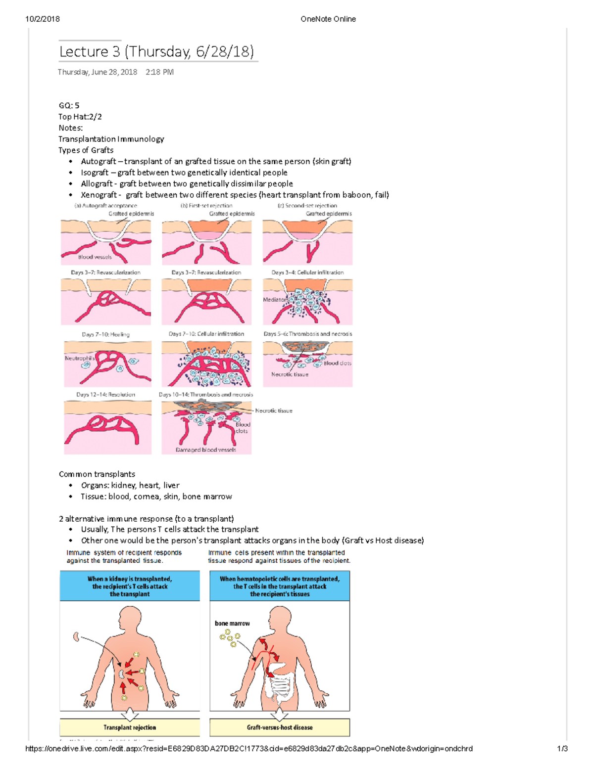 Lecture 3 Test 4 - OneNote Online Lecture 3 (Thursday, Thursday, June ...