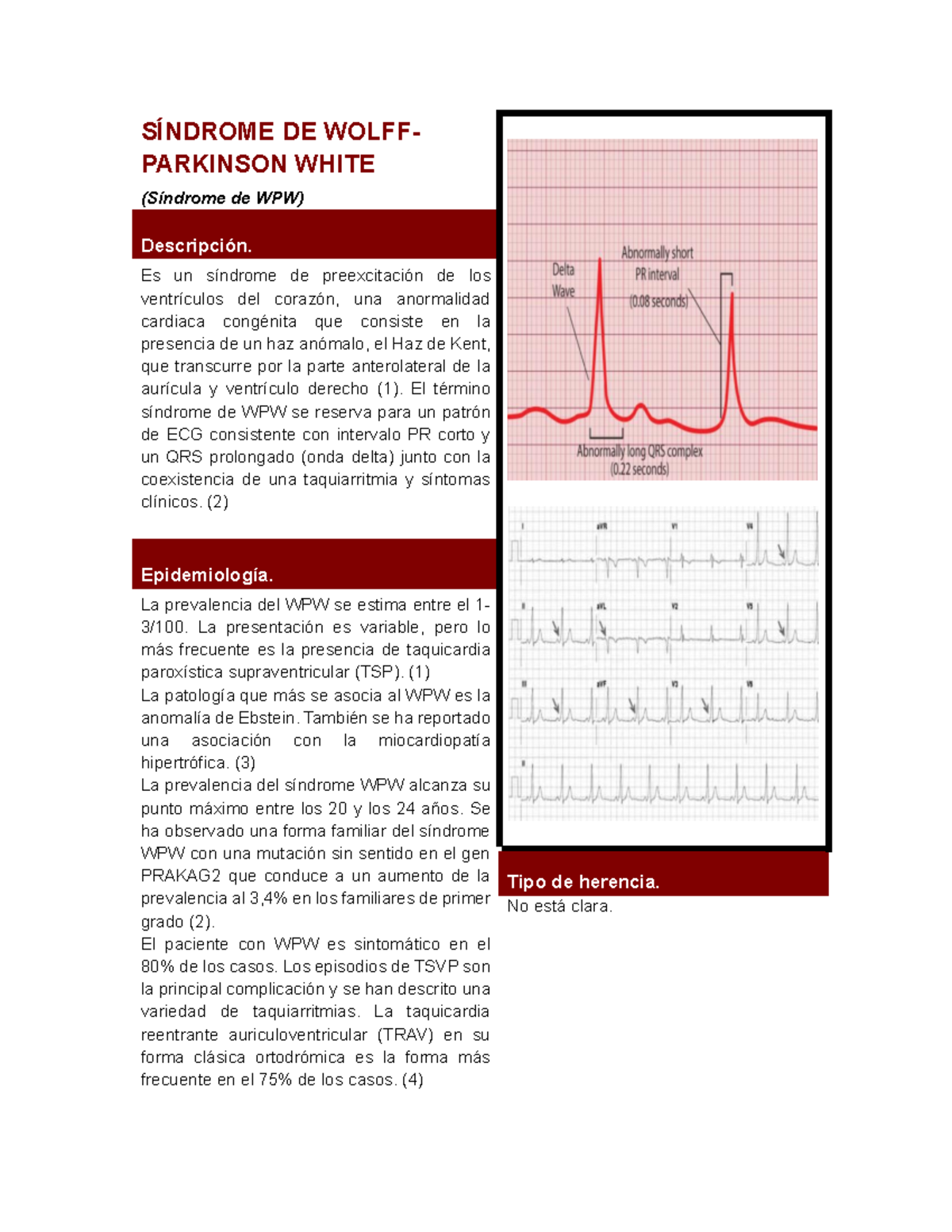Sx. Wolff-Parkinson White - SÍNDROME DE WOLFF- PARKINSON WHITE ...