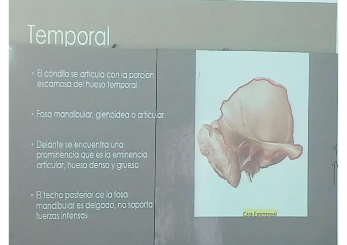 Clase 2 Oclusión - emporal 8 cóndilo se articula con la porción ...