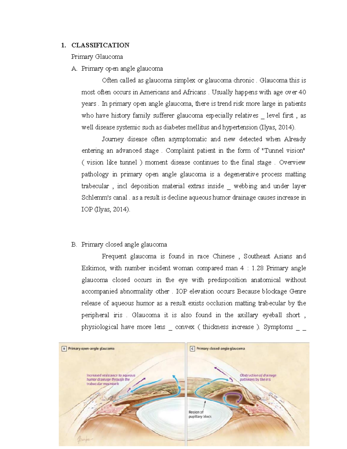 Classification Patophyisiology Primary Glaucoma - 1. CLASSIFICATION ...