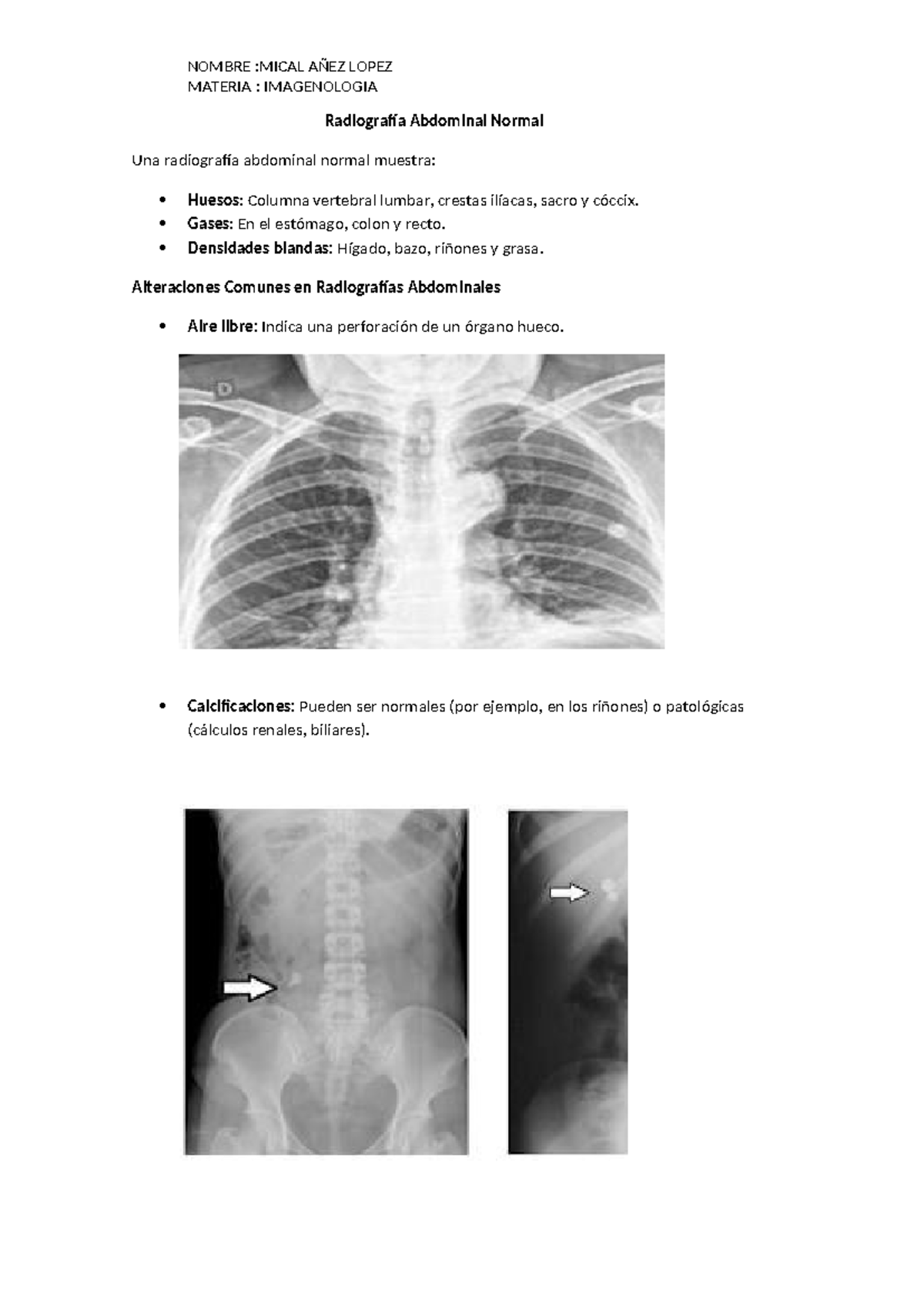 Radiografía Abdominal Normal - MATERIA : IMAGENOLOGIA Radiografía ...