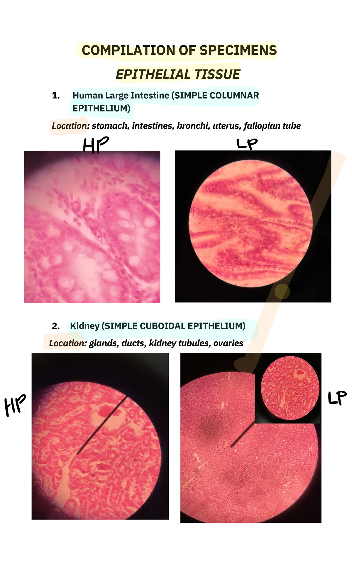 Specimens-Tissue - lab histology - COMPILATION OF SPECIMENS EPITHELIAL ...