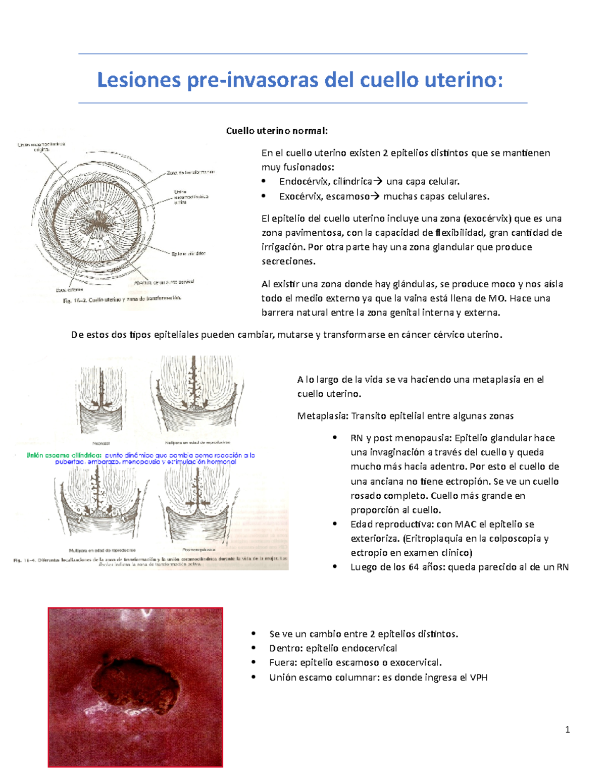 11. lesiones pre invasoras del cuello uterino - Lesiones pre-invasoras del cuello uterino ...